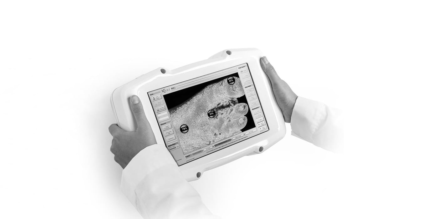 Kent Imaging Becomes Net Health’s First Integrated Imaging Device - TVM ...